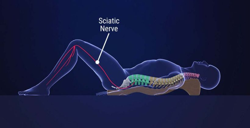 Can Sciatica Affect Both Sides At The Same Time? | American Chiropractors